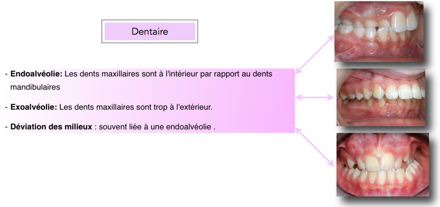 Diagnostic et plan de traitement - Orthodontiste
