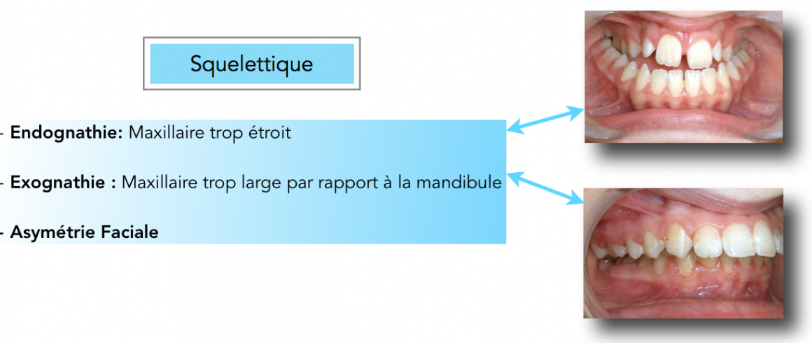 Diagnostic et plan de traitement - Orthodontiste