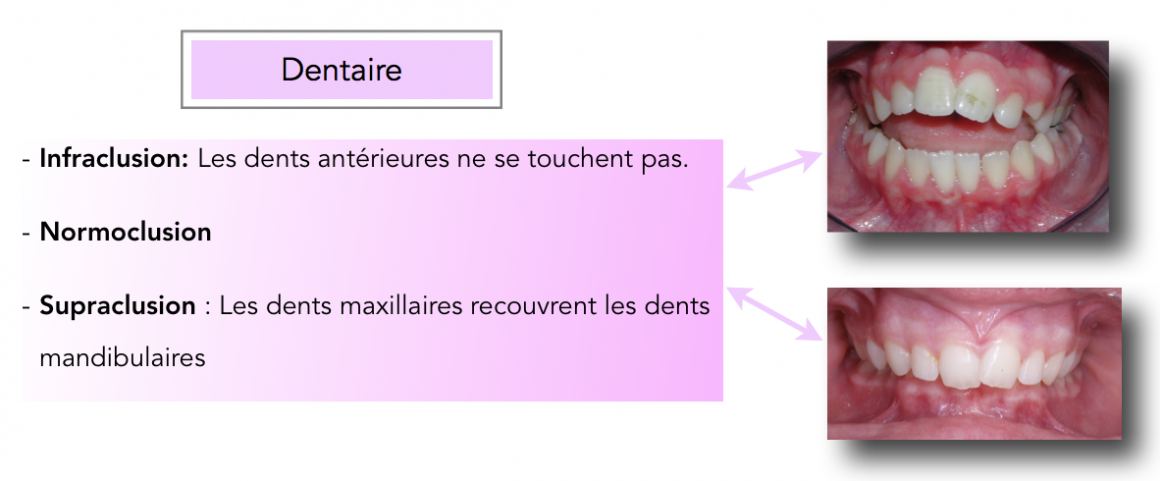 Diagnostic et plan de traitement - Orthodontiste